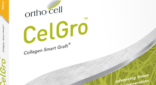 Orthocell - The Next Big Winner In The Regenerative Sector - ShareCafe