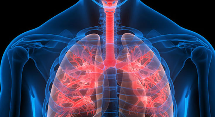 Bhronchitol FDA Approval Transformative for Pharmaxis - ShareCafe