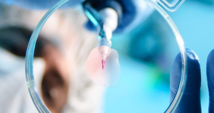 For a Life Free of Pain - ShareCafe